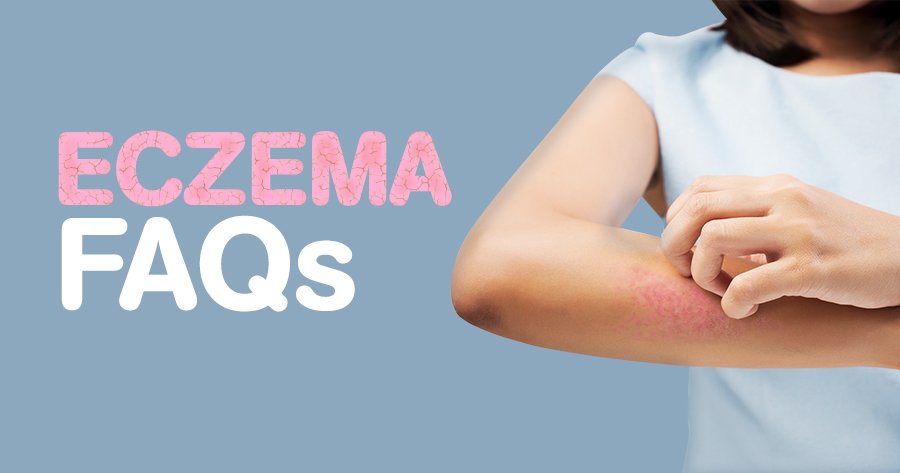 Everything You Need To Know About Eczema Guides